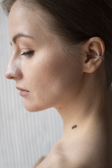 Mole Removal Healing Time | Expert Tips | Dr. Ardesh